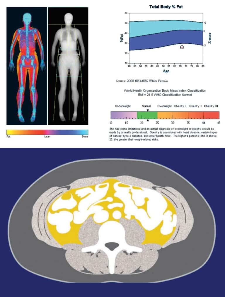 Hologic Horizon Wi Bone Density Machine for Sale | Amber Diagnostics