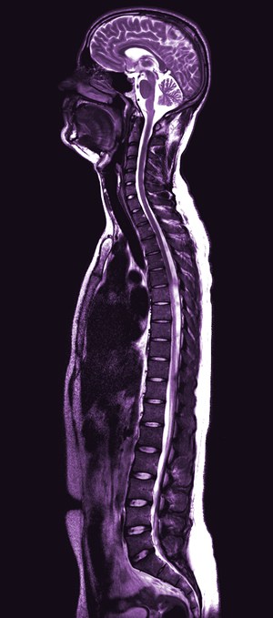 A Major Magnetic Resonance Imaging Step Forward