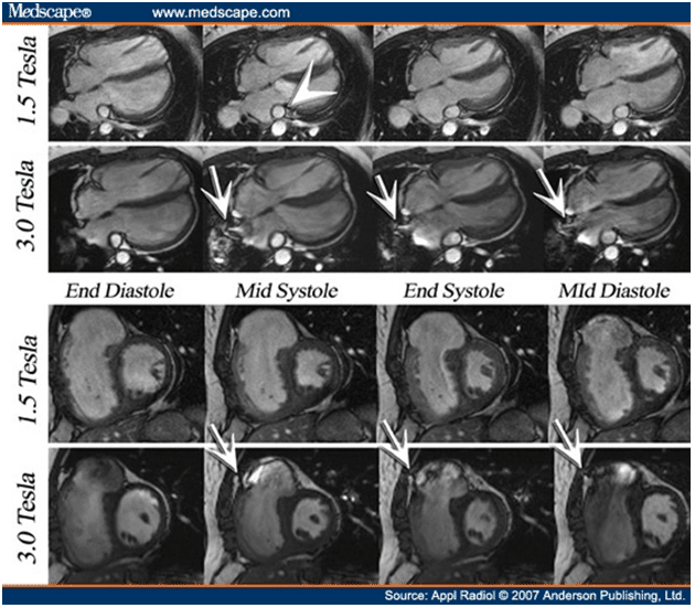 ﻿Visual Comparison of 3T and 1.5T MRI | Amber Diagnostics