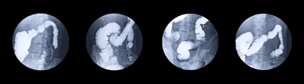 C-Arm, Fluoroscopy And Image Aquisition | Amber Diagnostics