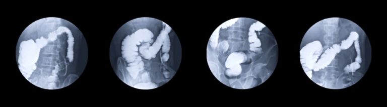 C-Arm, Fluoroscopy And Image Aquisition | Amber Diagnostics